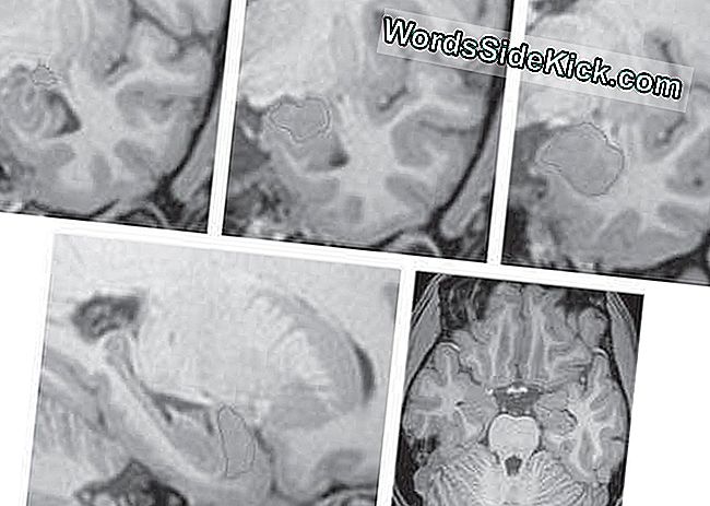 Criminal Minds Zijn Anders Dan De Jouwe, Brain Scans Reveal - 2023 ... Criminal Minds Zijn Anders Dan De Jouwe, Brain Scans Reveal - 2023 ...