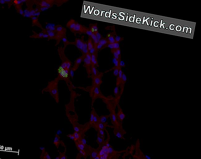 科学者は最も小さい血管を作成します - 2024 | 健康 科学者は最も小さい血管を作成します - 2024 | 健康