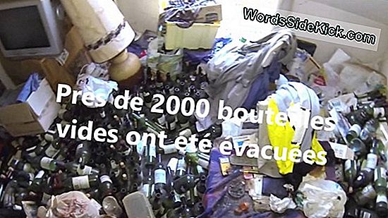 Le Syndrome De Rapunzel A Provoqué Les Symptômes Étranges De La Femme